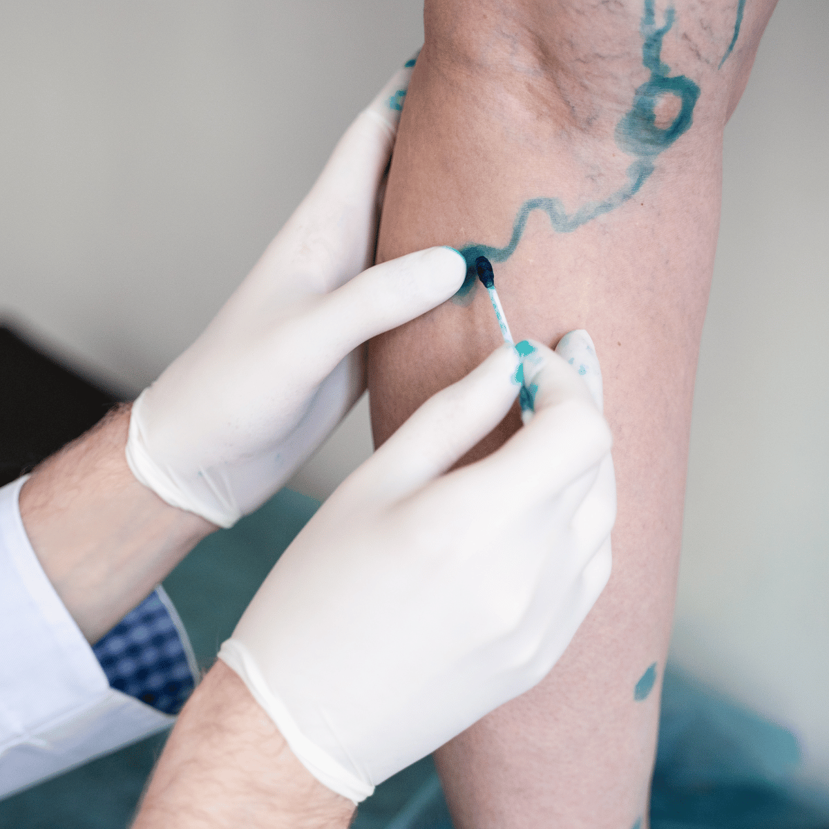 Compendium of Knowledge on Vascular Skin – E-Drug